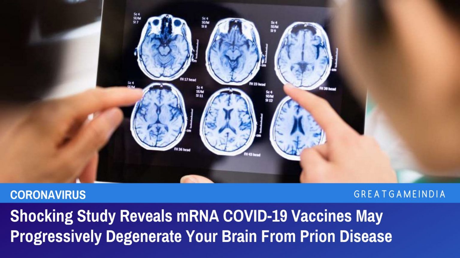 Shocking Study Reveals mRNA COVID-19 Vaccines May Progressively ...
